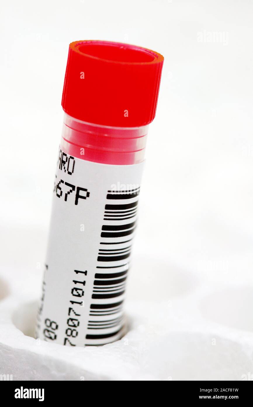 Blood sample in a haematology laboratory. The vacutainer is barcoded so ...