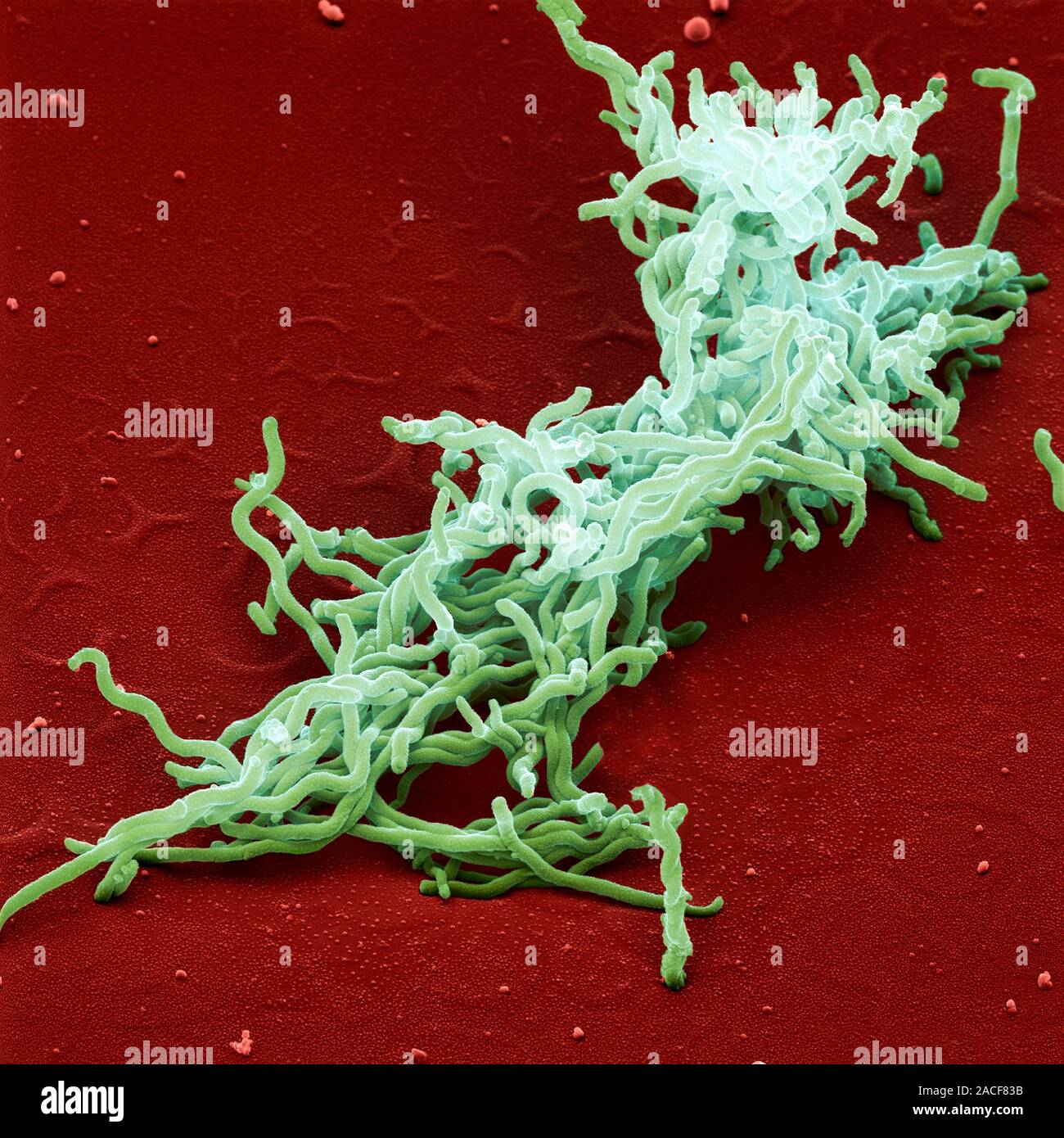 Lyme disease bacteria. Coloured scanning electron micrograph (SEM) of ...