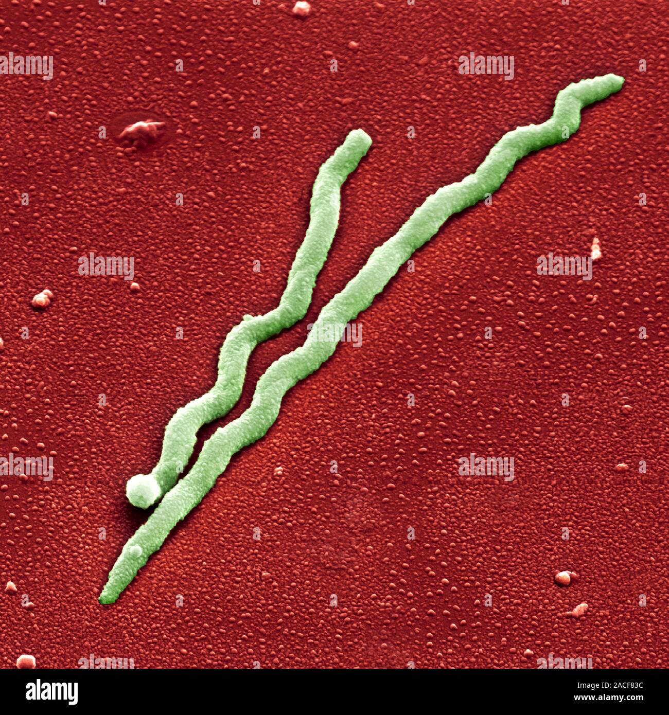 Lyme disease bacteria. Coloured scanning electron micrograph (SEM) of ...