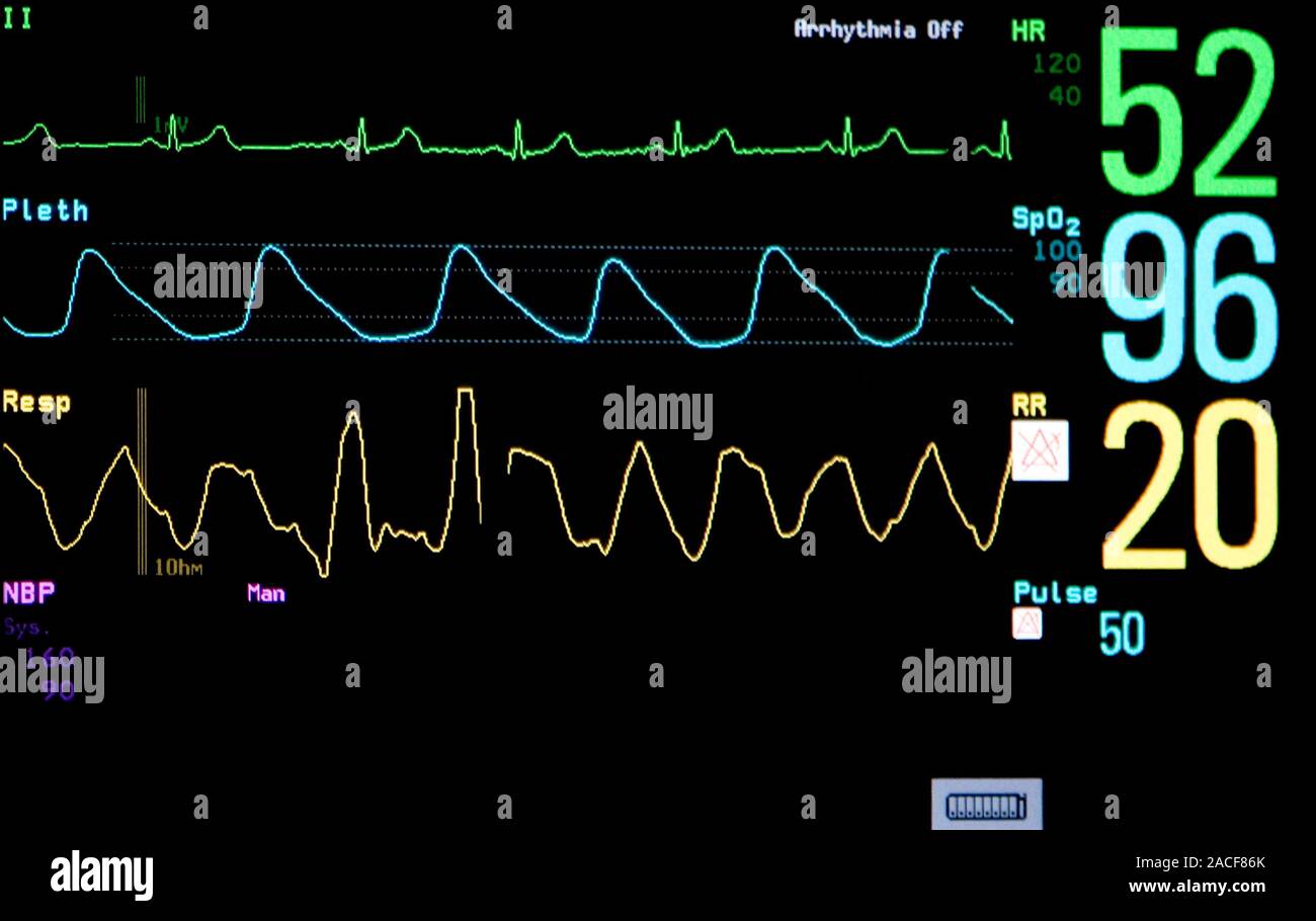 This is a real situation. Image not to be used in a defamatory context ...