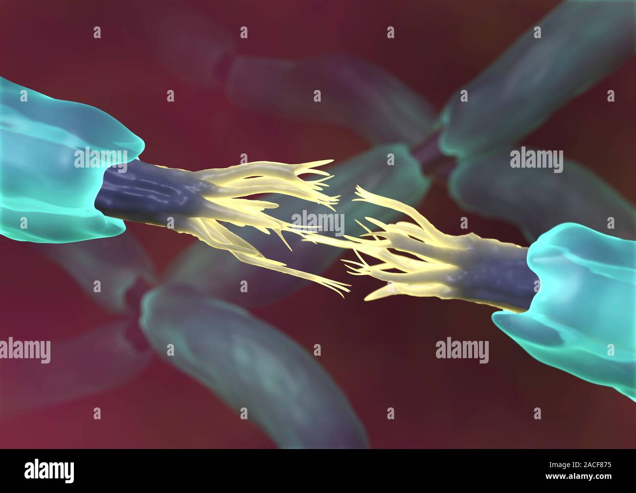 Severed nerve, computer artwork. The protective covering of the nerve ...