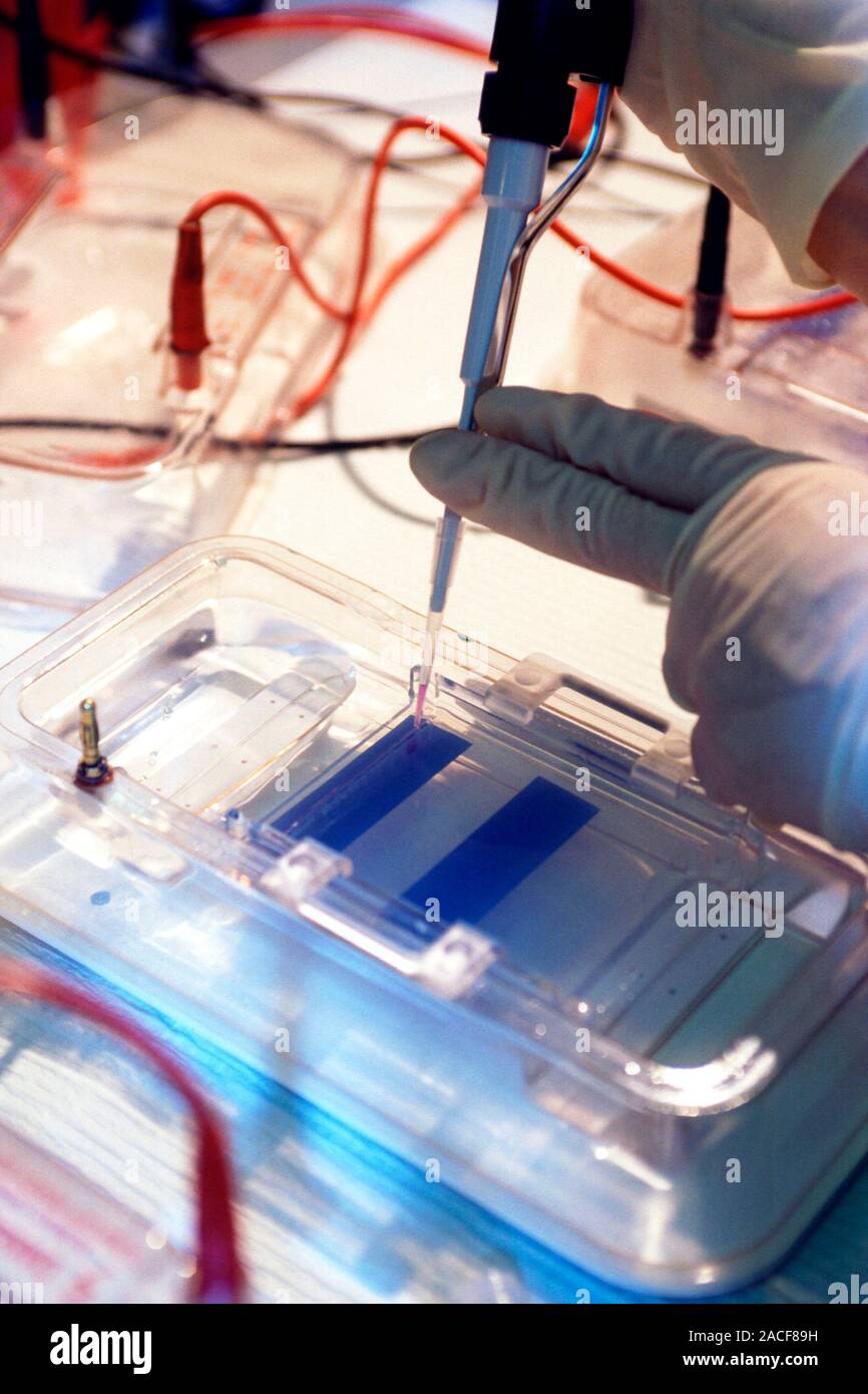 Potato DNA testing. Close-up of a researcher loading potato DNA ...