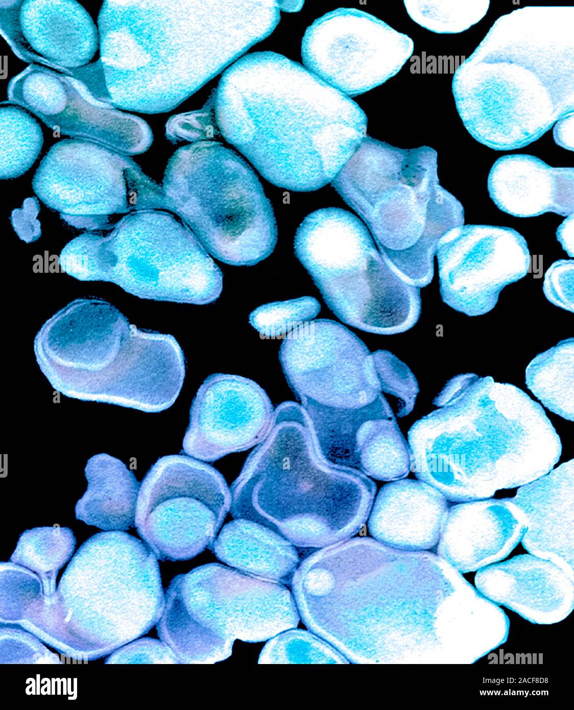 Liposome vesicles, coloured transmission electron micrograph (TEM ...