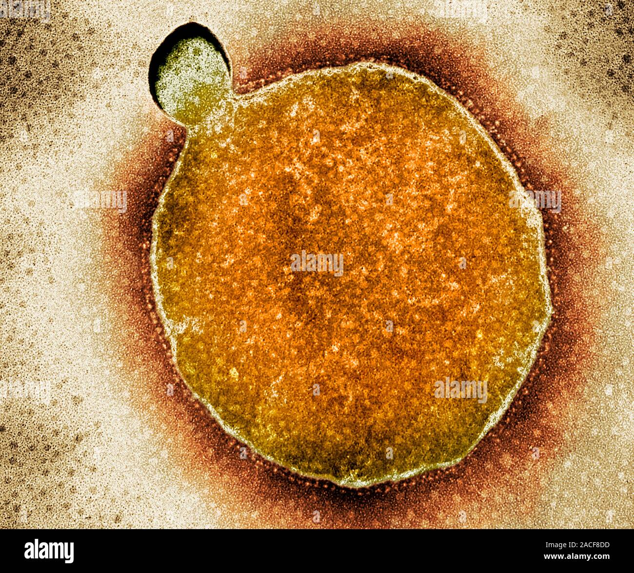 Mycoplasma sp. bacteria, coloured transmission electron micrograph (TEM ...