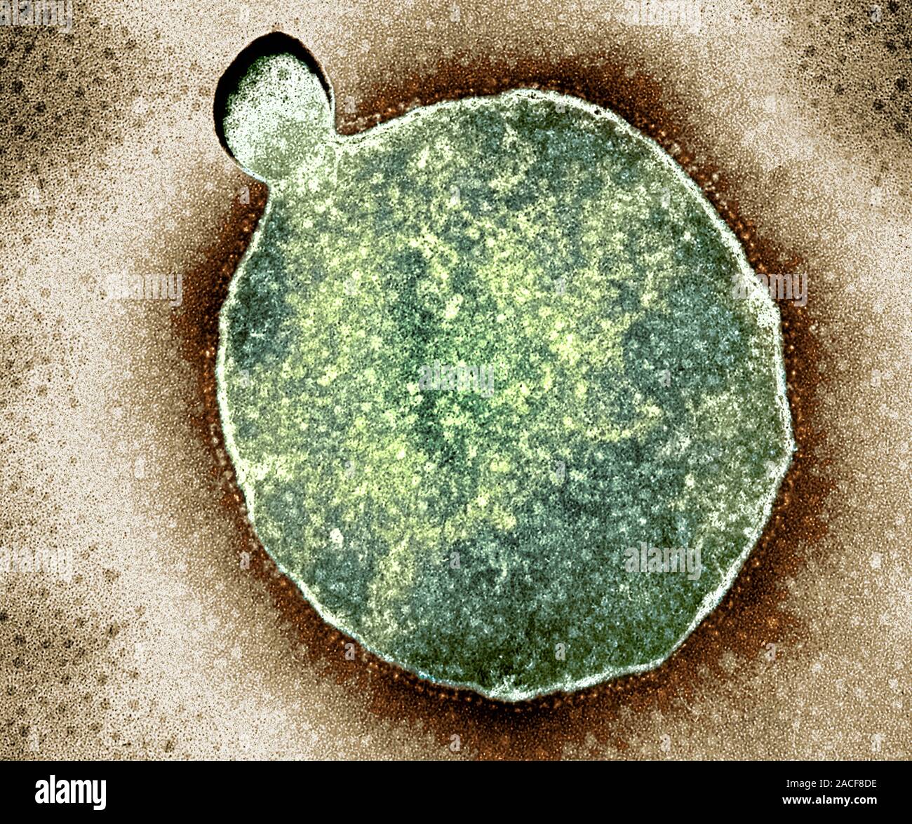 Mycoplasma sp. bacteria, coloured transmission electron micrograph (TEM ...