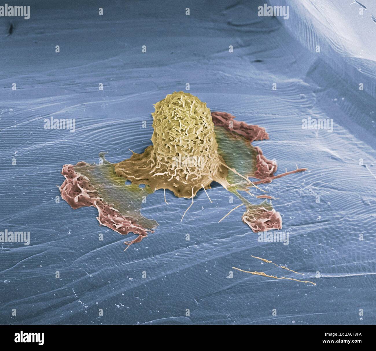 Macrophage on a titanium plate, coloured scanning electron micrograph (SEM). Macrophages are ...