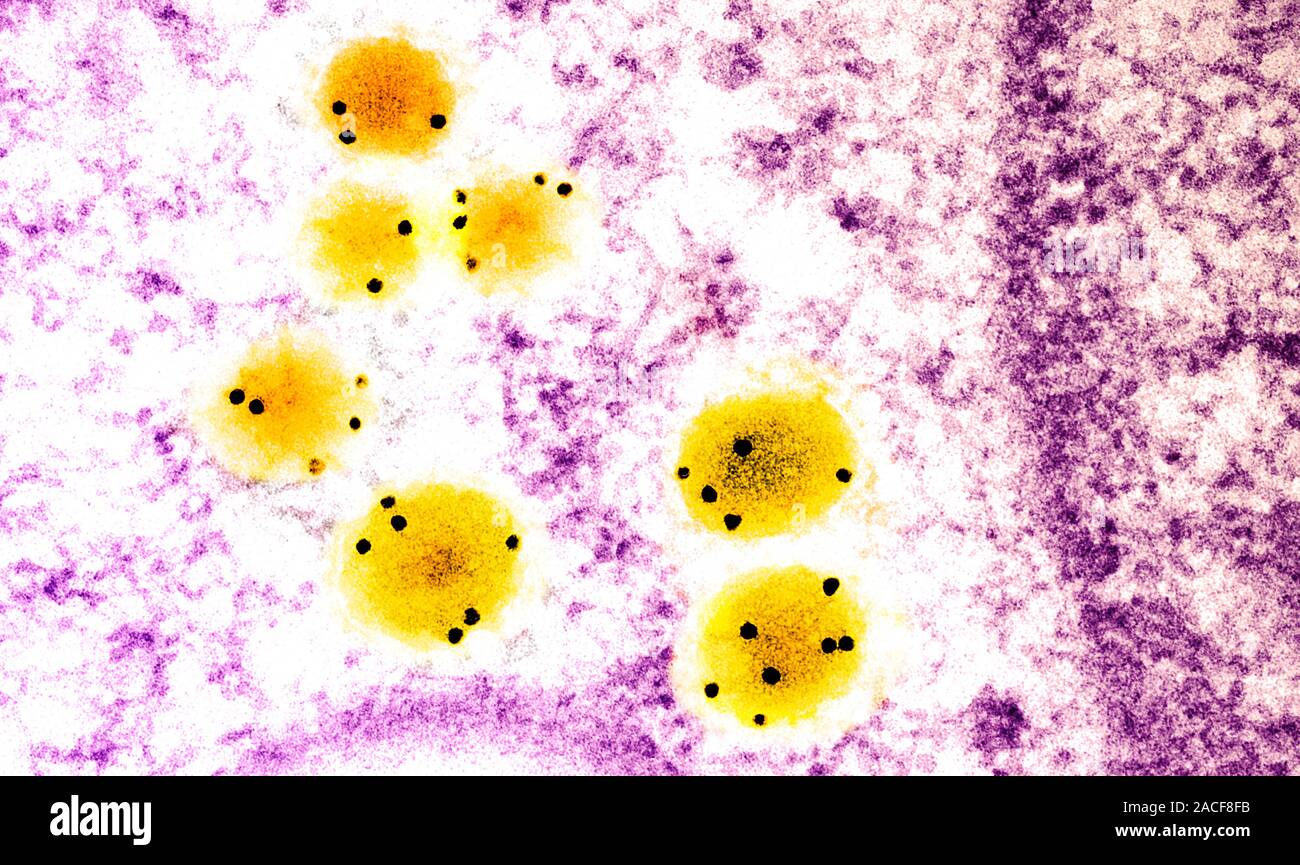 Immuno-gold labelling. Coloured transmission electron micrograph (TEM ...
