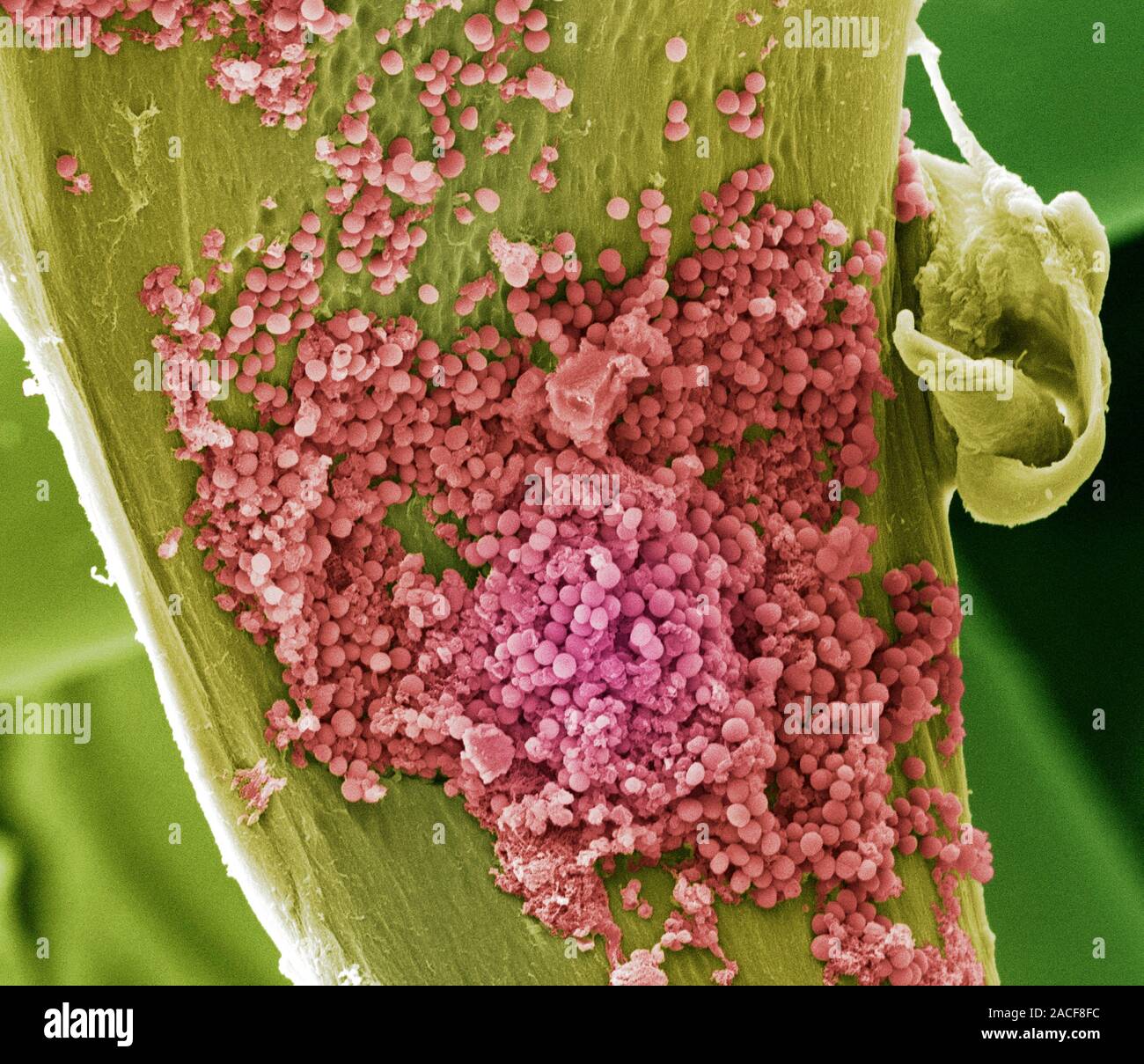 MRSA bacteria, coloured scanning electron micrograph (SEM). Methicillin ...