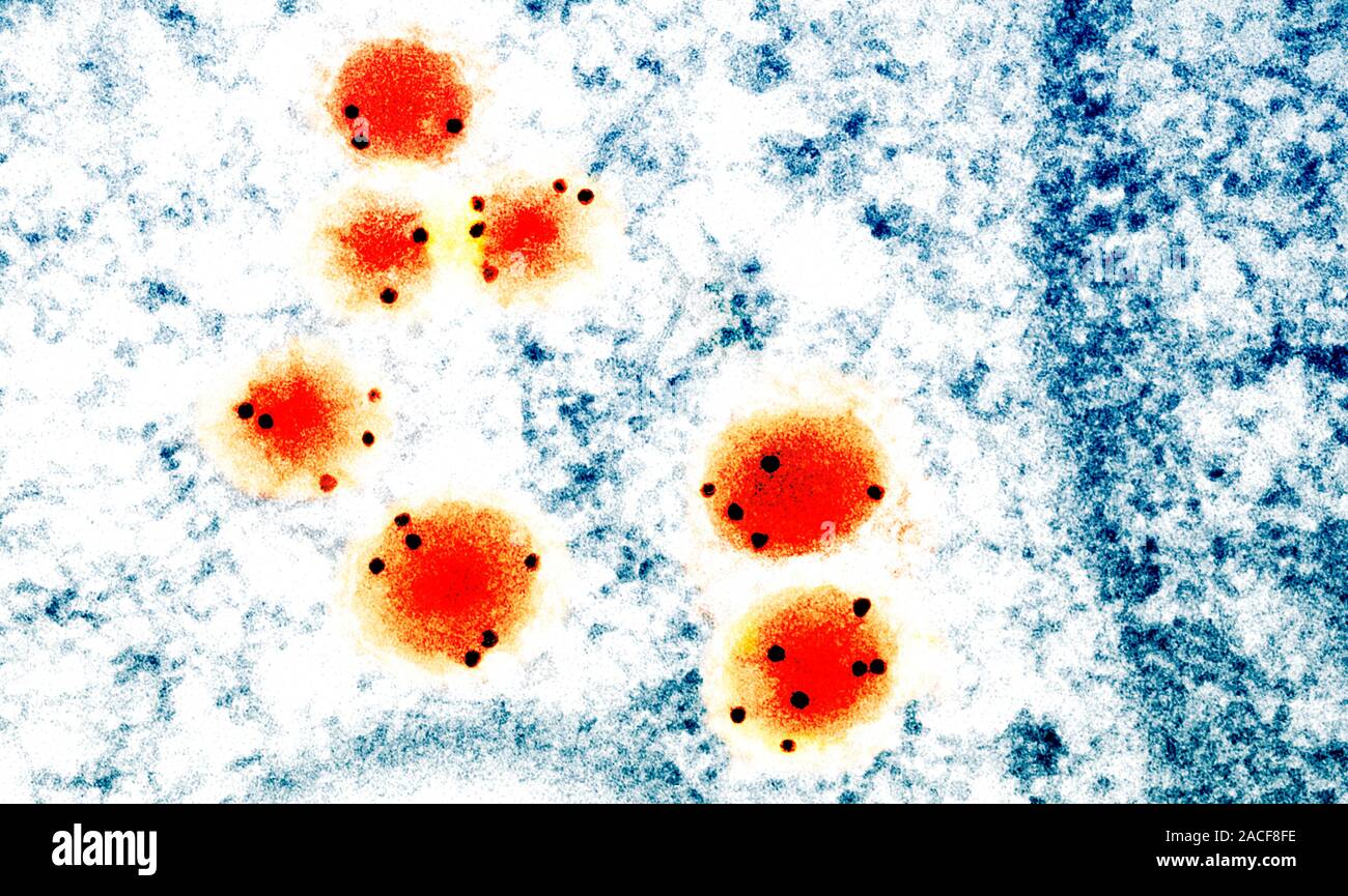 Immuno-gold labelling. Coloured transmission electron micrograph (TEM ...