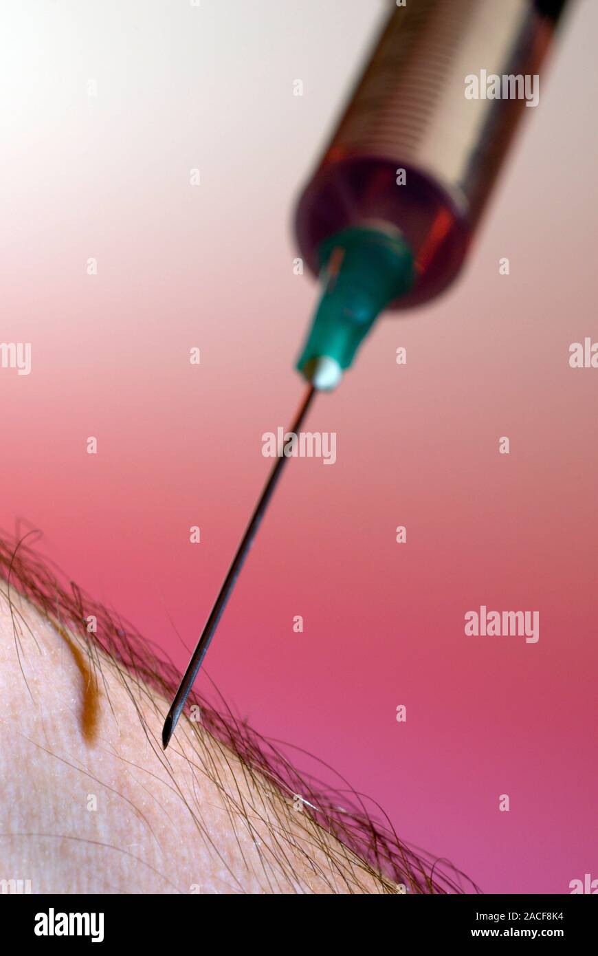 Injection. Close-up of the needle of a syringe about to be inserted ...