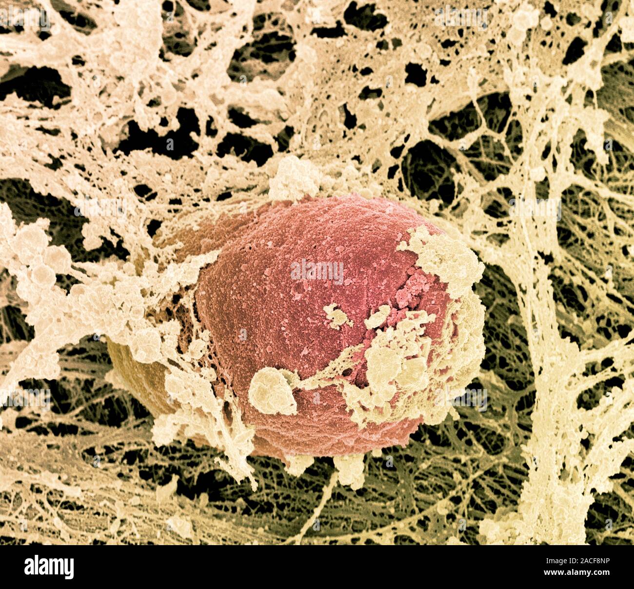 Osteoblast bone cell surrounded by osteoid (cream), coloured scanning ...