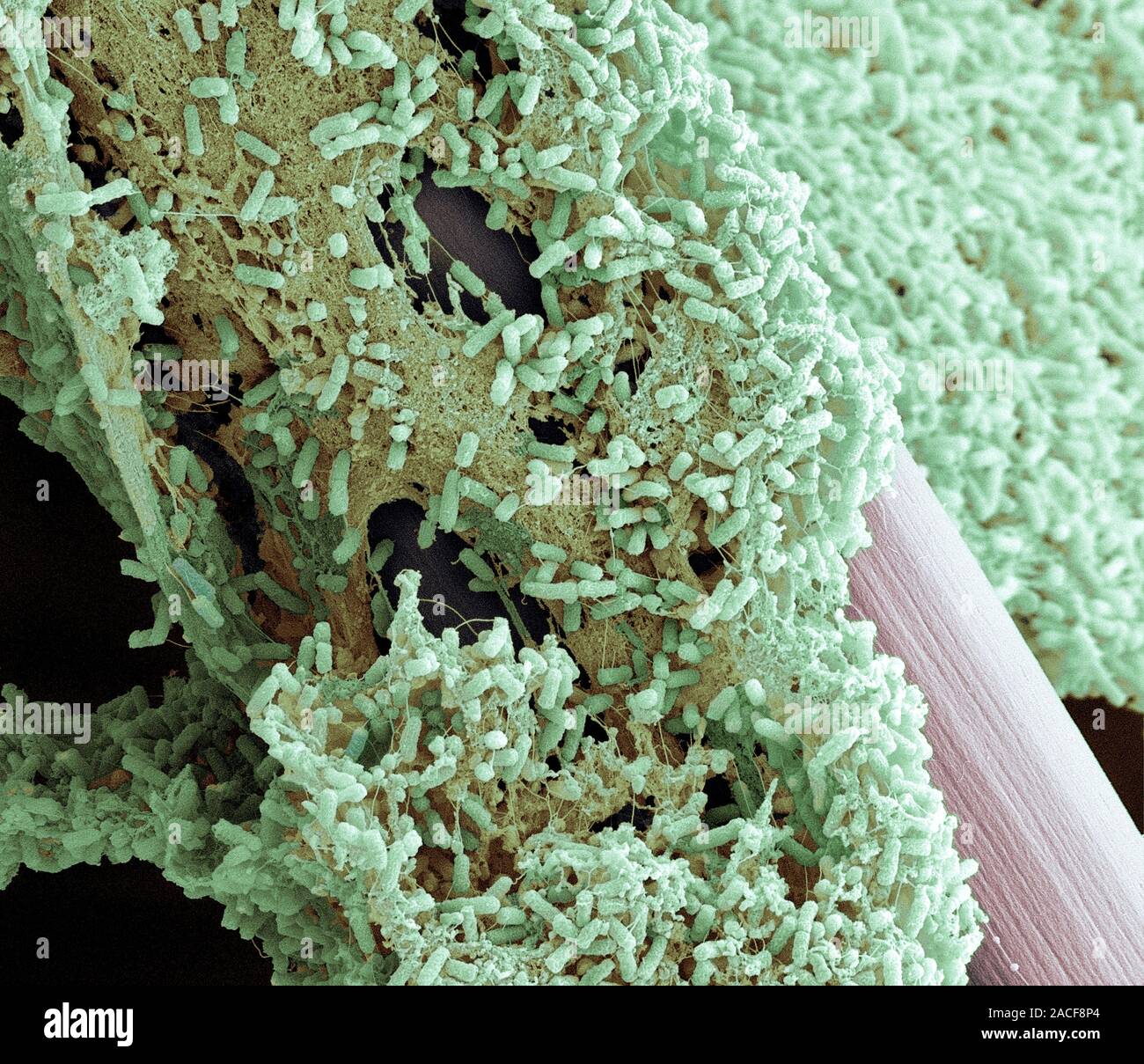 Pseudomonas Aeruginosa Bacteria Coloured Scanning Electron Micrograph Sem These Gram