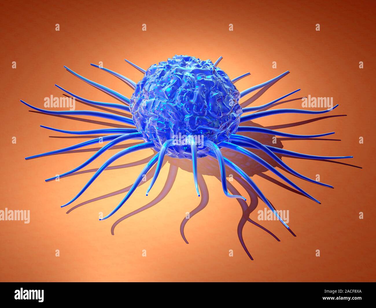 Cancer cell, computer artwork. The uneven surface and cytoplasmic ...
