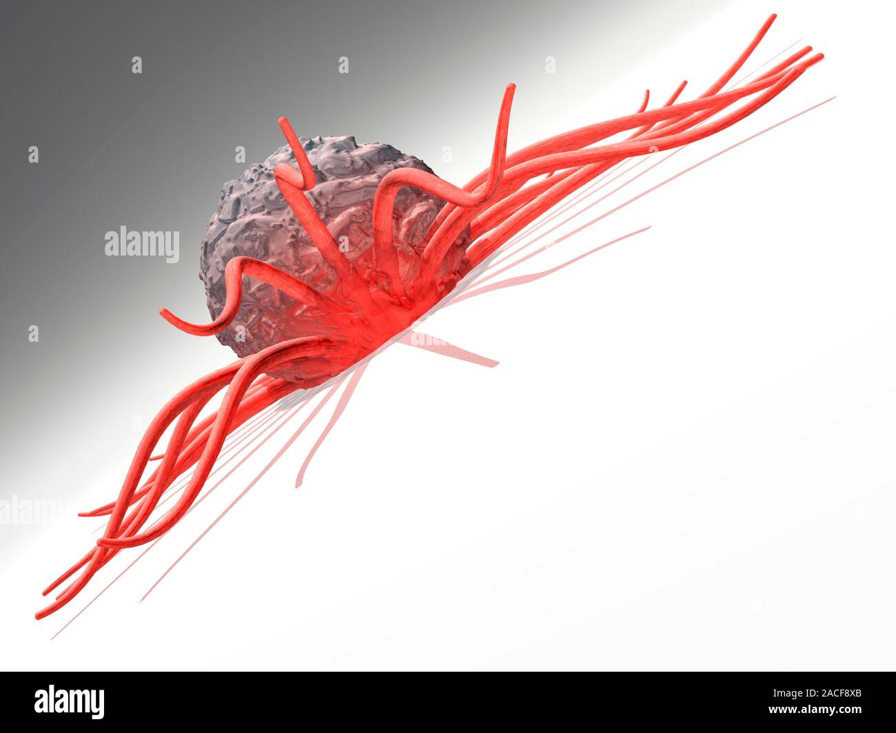 Cancer cell, computer artwork. The uneven surface and cytoplasmic ...