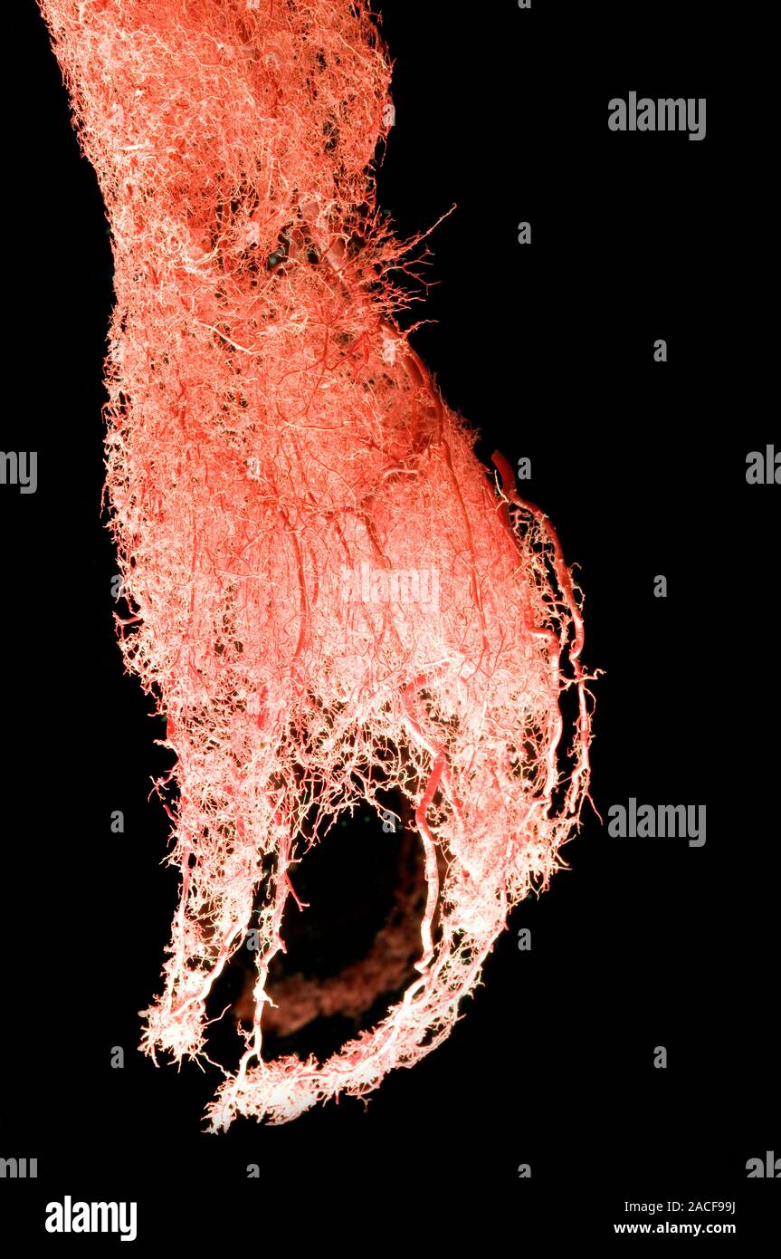 Plastinated hand blood vessels. The technique of plastination conserves ...