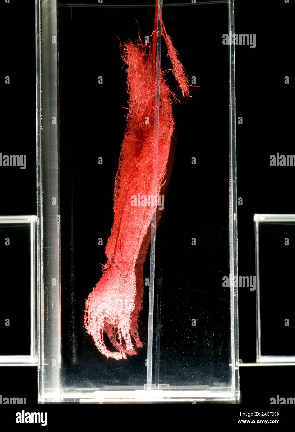 Plastinated arm blood vessels exhibit. The technique of plastination ...