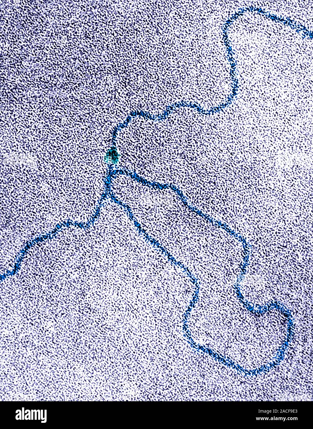 DNA (deoxyribonucleic acid) molecule, coloured transmission electron ...