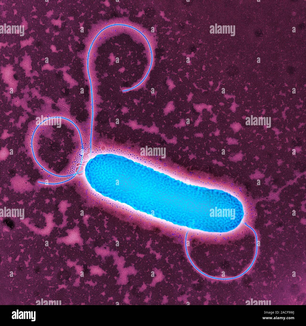 Stenotrophomonas maltophilia bacteria, coloured transmission electron ...