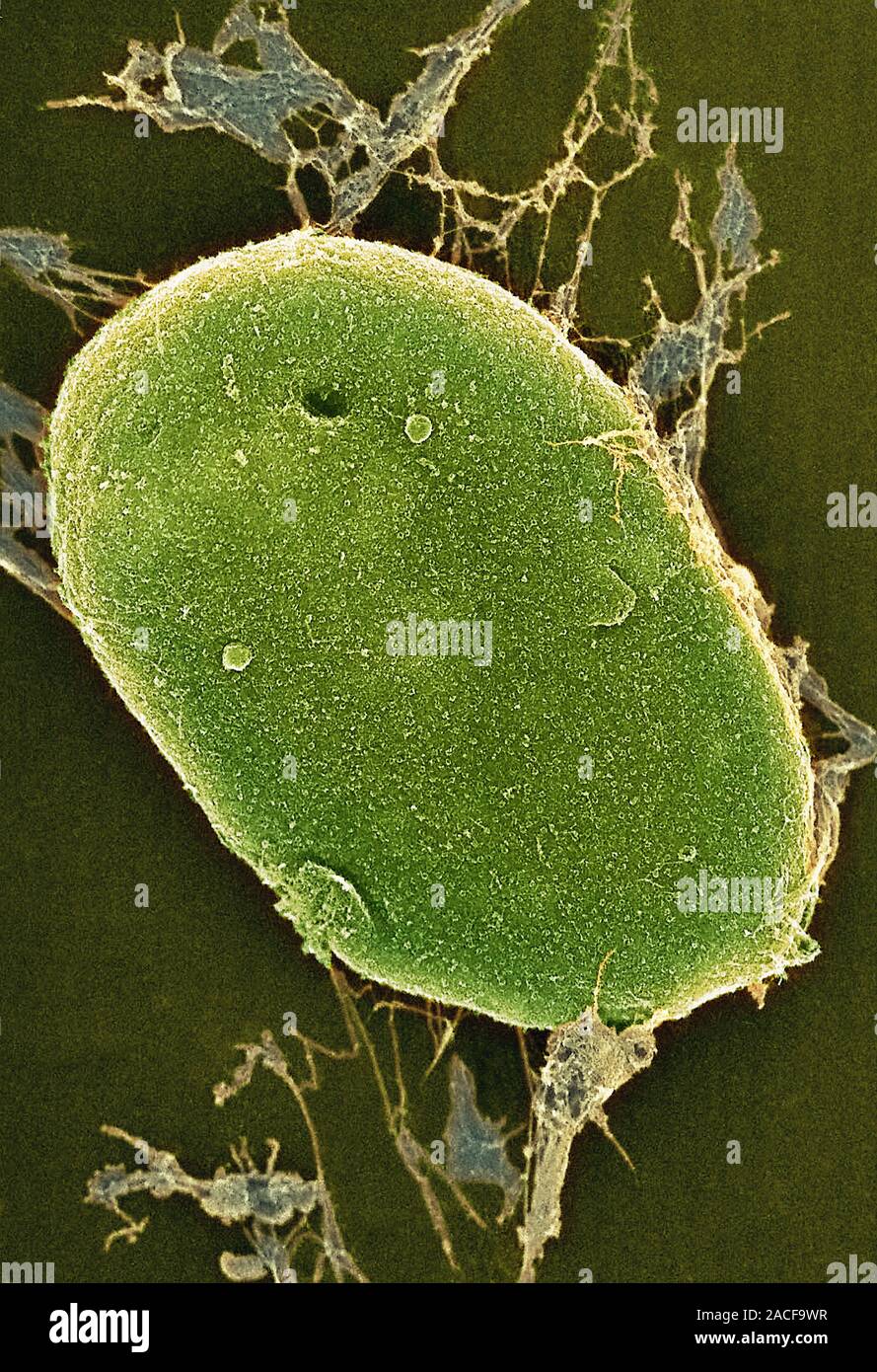 Cell nucleus, coloured scanning electron micrograph (SEM). The cell ...