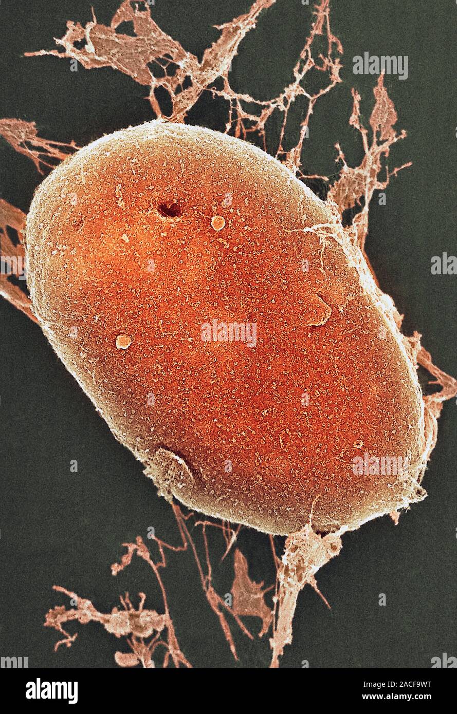 Cell nucleus, coloured scanning electron micrograph (SEM). The cell ...