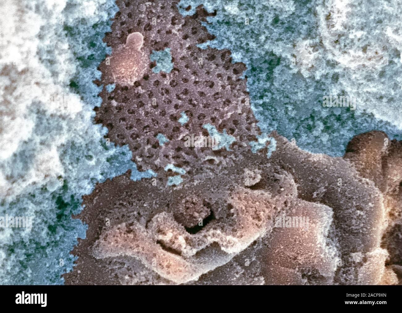 Kidney glomerulus surface. Coloured scanning electron micrograph (SEM ...