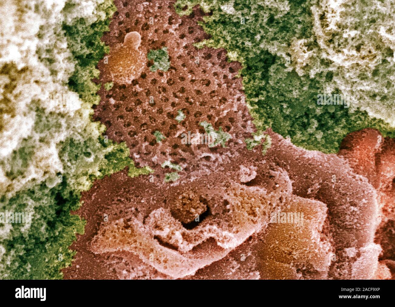 Kidney glomerulus surface. Coloured scanning electron micrograph (SEM ...