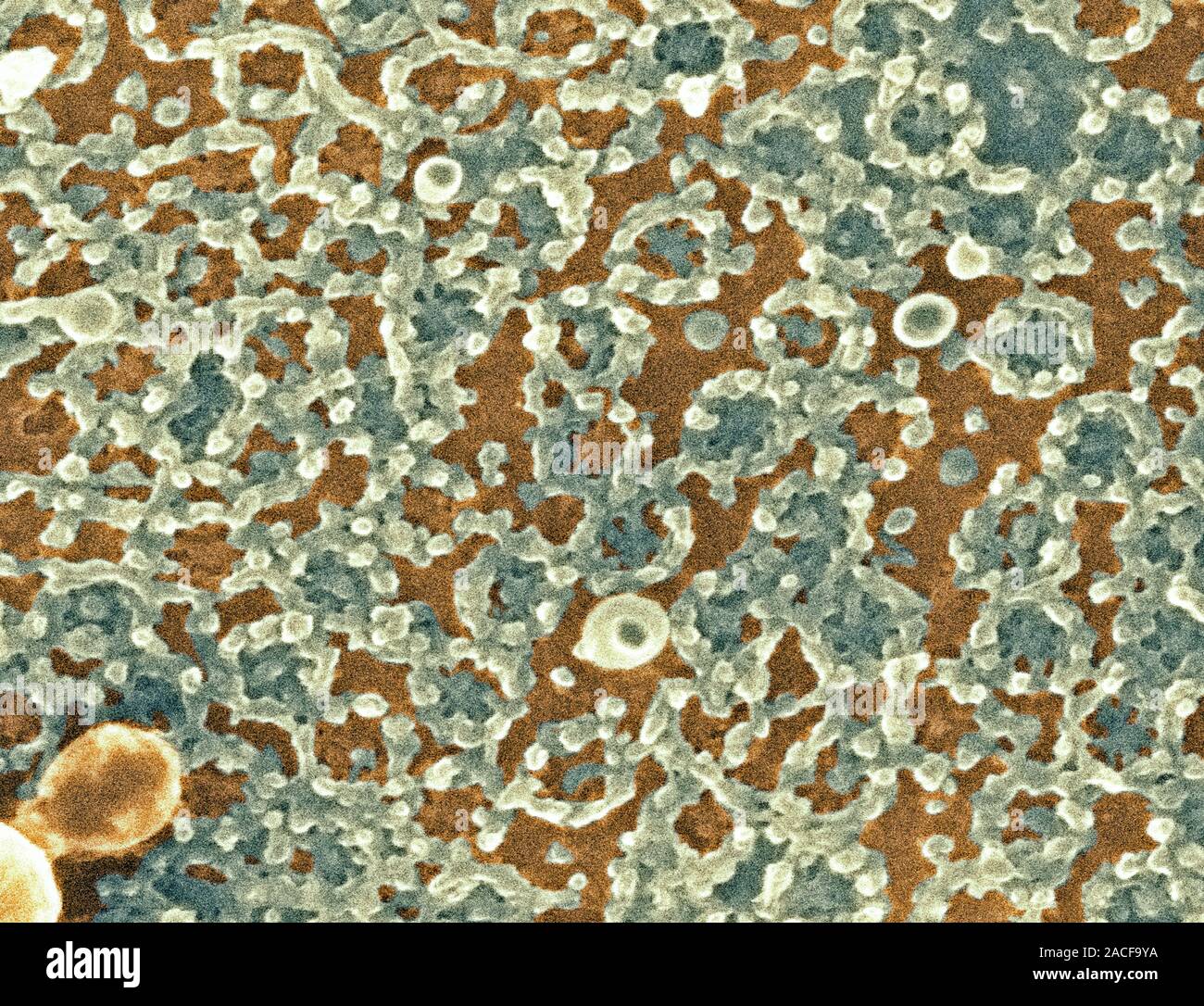 Nuclear pore complexes. Coloured scanning electron micrograph (SEM) of ...