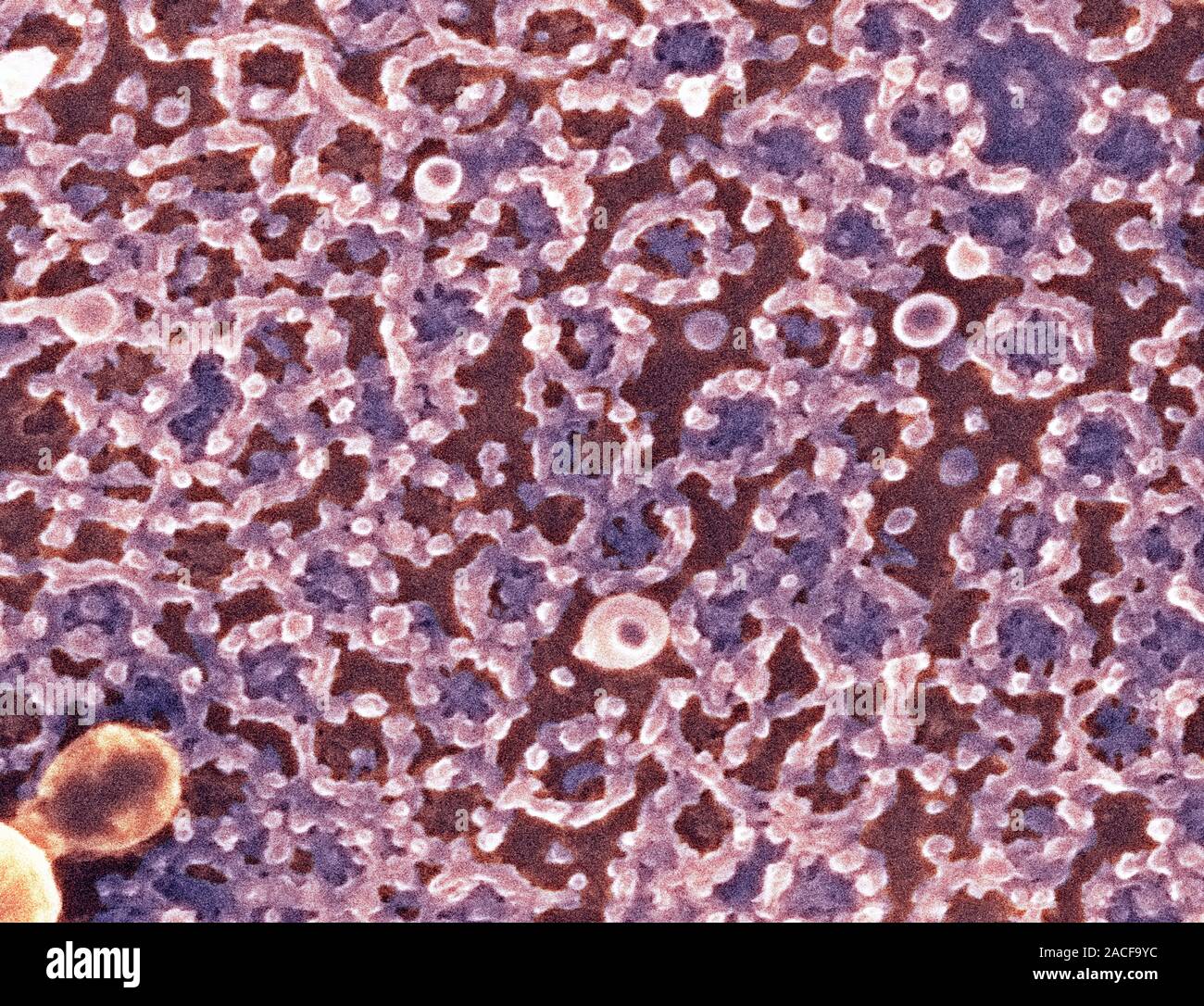 Nuclear pore complexes. Coloured scanning electron micrograph (SEM) of ...