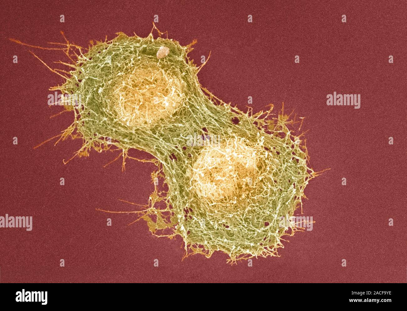 Cell division. Coloured scanning electron micrograph (SEM) of two ...