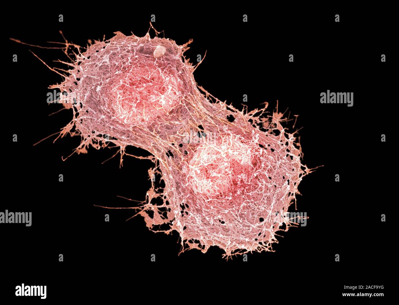 Cell division. Coloured scanning electron micrograph (SEM) of two ...