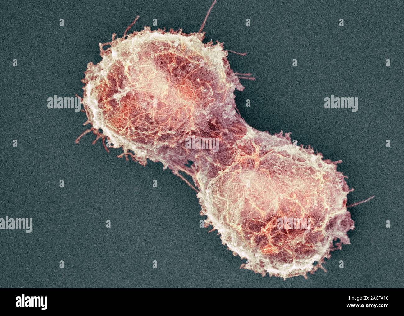 Cell division. Coloured scanning electron micrograph (SEM) of two ...