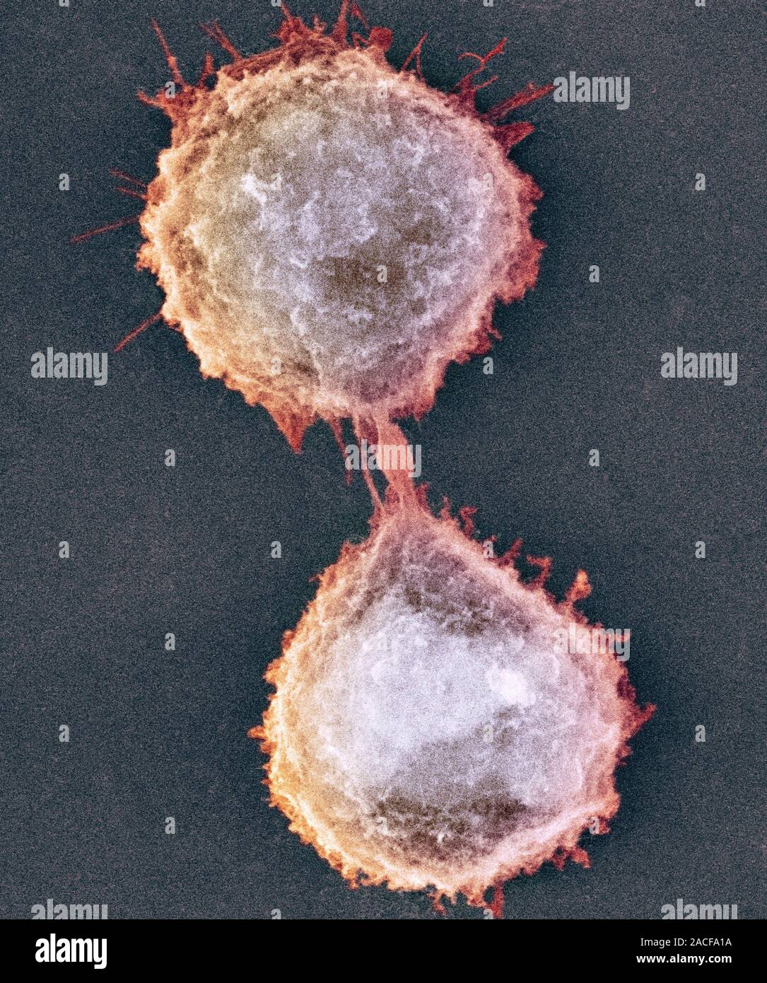 Cell division. Coloured scanning electron micrograph (SEM) of two ...