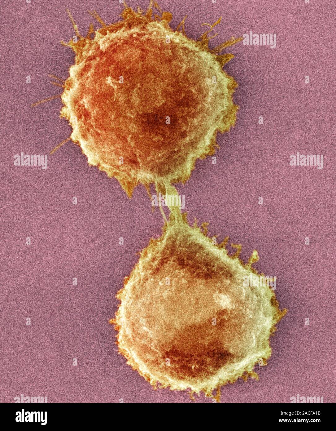 Cell division. Coloured scanning electron micrograph (SEM) of two ...