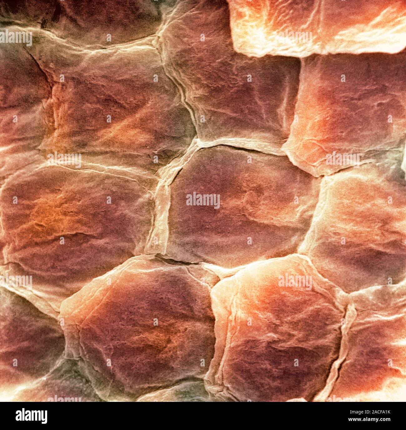 Skin surface. Coloured scanning electron micrograph (SEM) of squamous ...