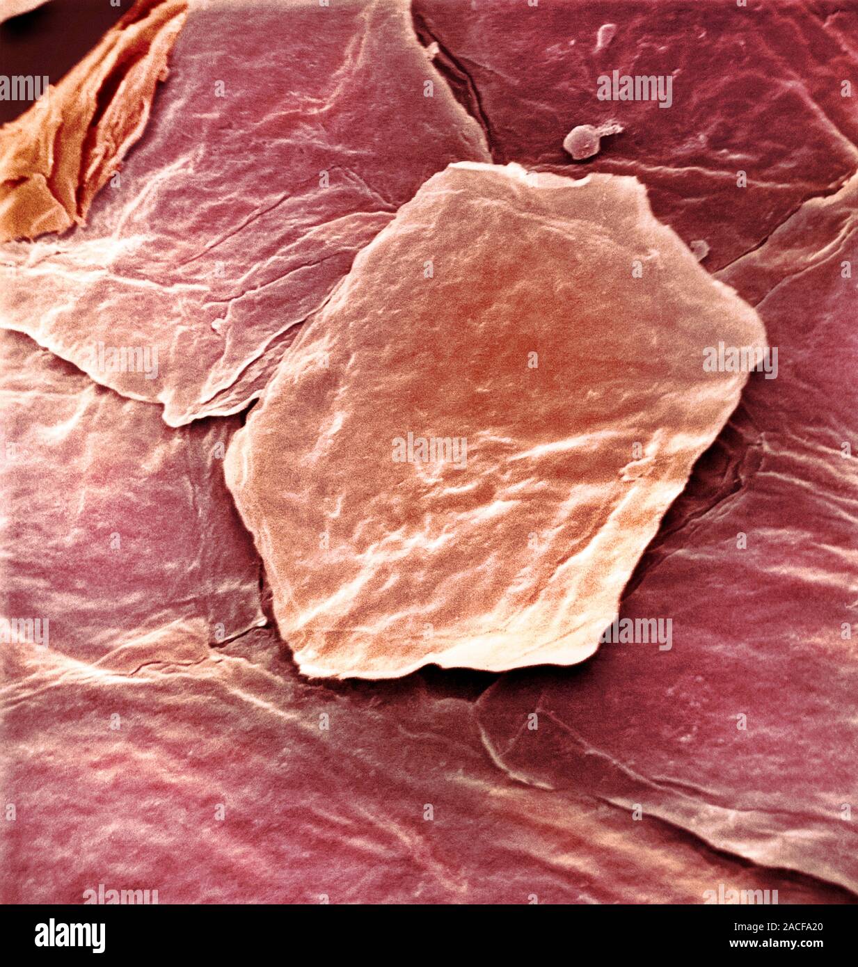 Skin cell. Coloured scanning electron micrograph (SEM) of a squamous ...