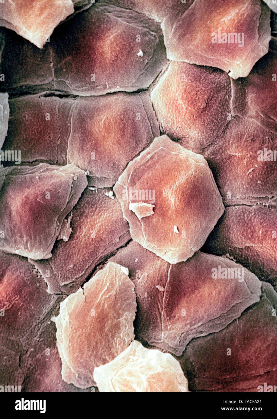 Skin surface. Coloured scanning electron micrograph (SEM) of squamous ...