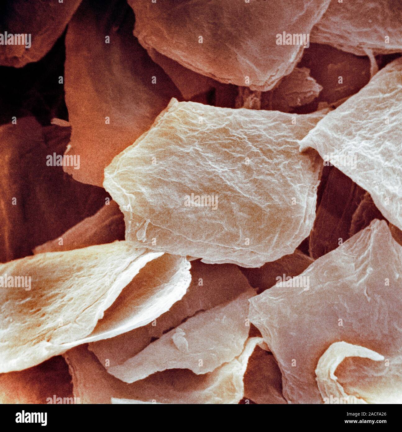 Skin cells. Coloured scanning electron micrograph (SEM) of squamous ...