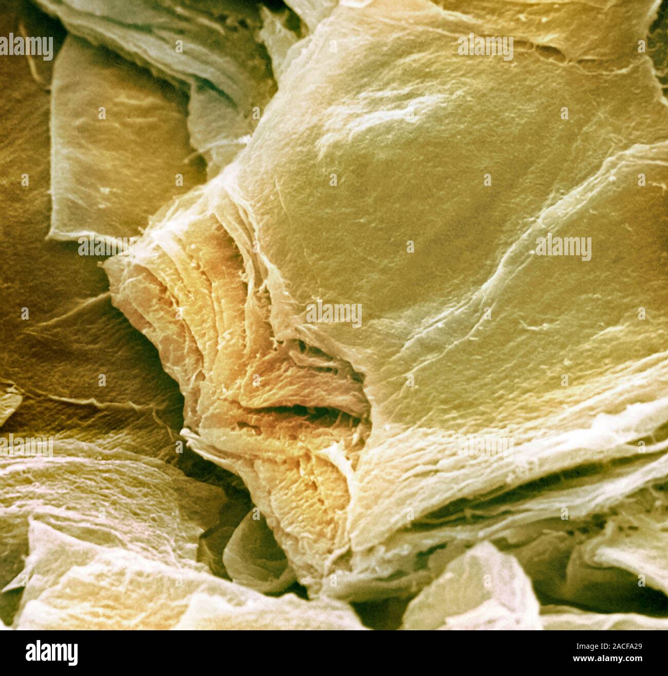 Skin surface. Coloured scanning electron micrograph (SEM) of fractured ...