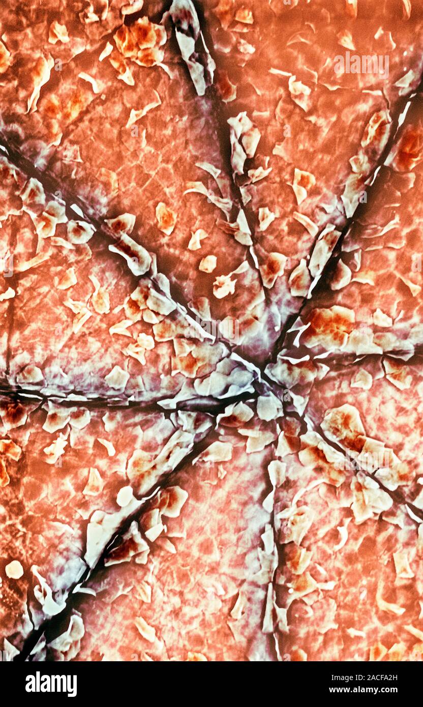 Human skin surface, coloured scanning electron micrograph (SEM). Ridges ...