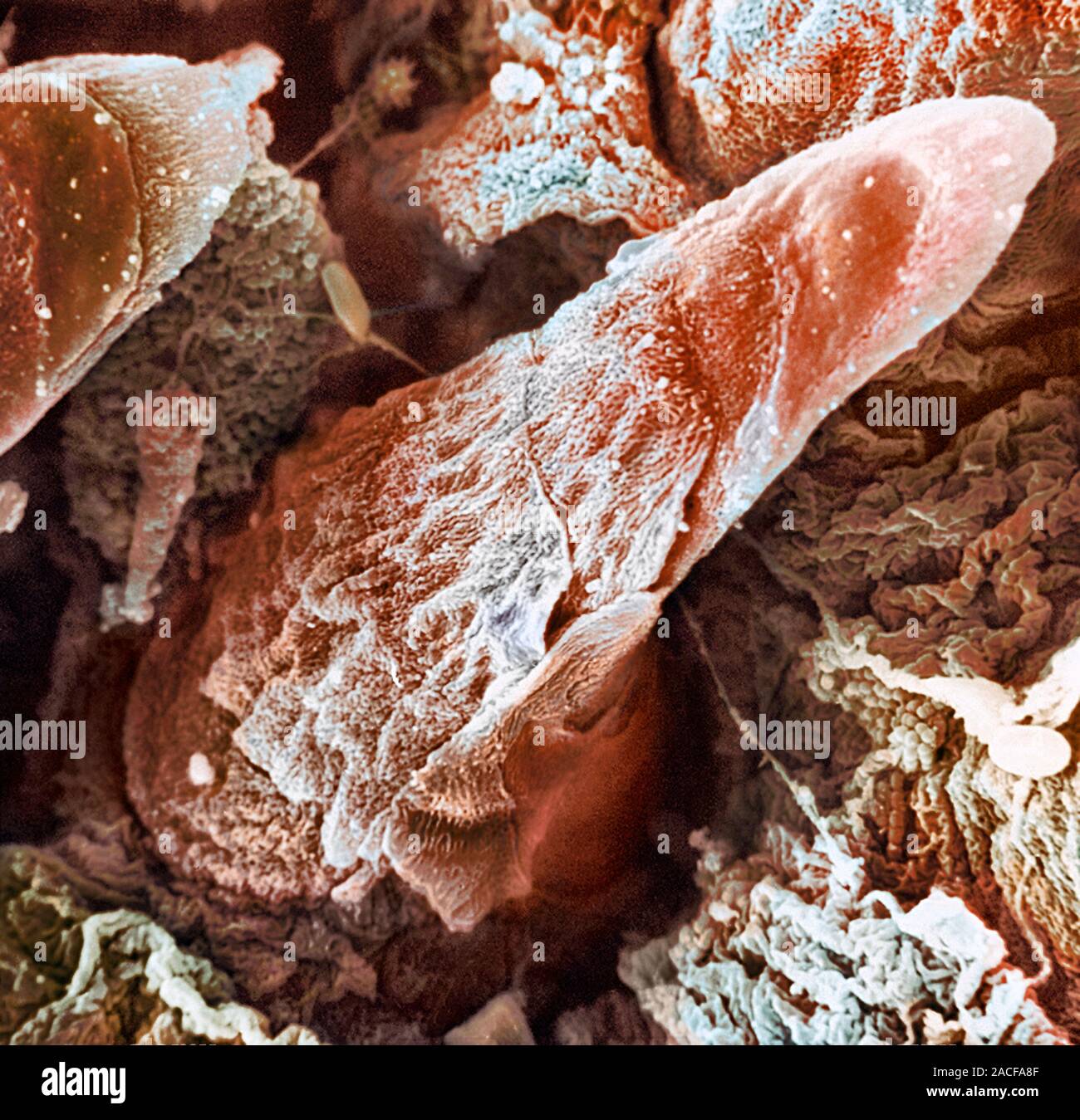 Mammalian tongue papillae. Coloured scanning electron micrograph (SEM ...