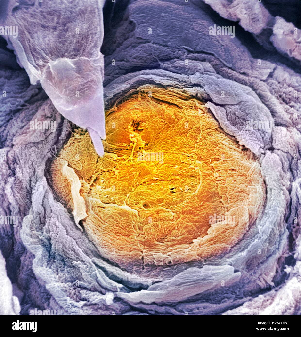 Mammalian tongue papillae. Coloured scanning electron micrograph (SEM ...