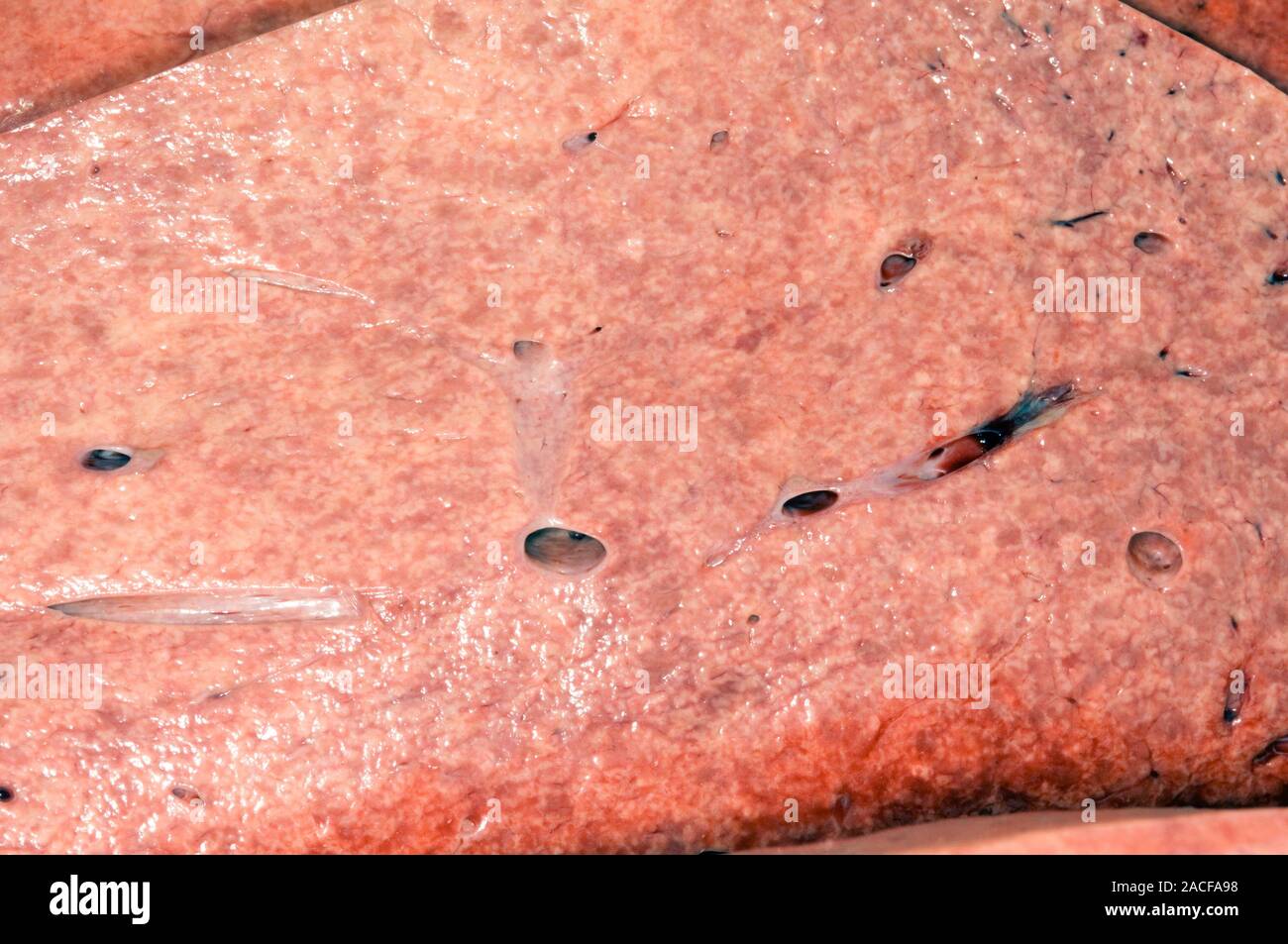 Fatty liver, post-mortem. Dissected liver from a patient who had fatty ...