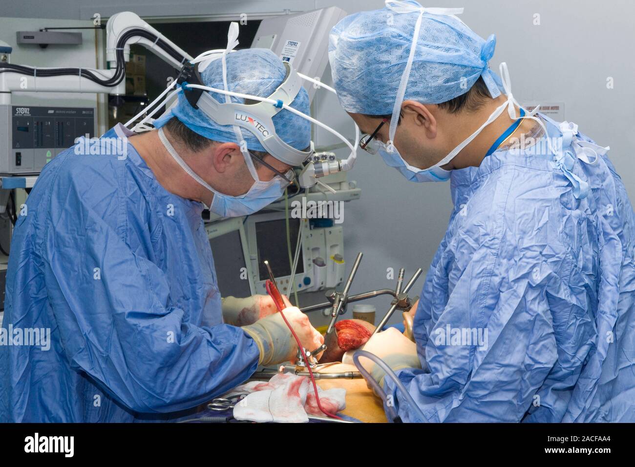 Oesophageal cancer surgery. Image 12 of 28. Surgeons opening up the ...