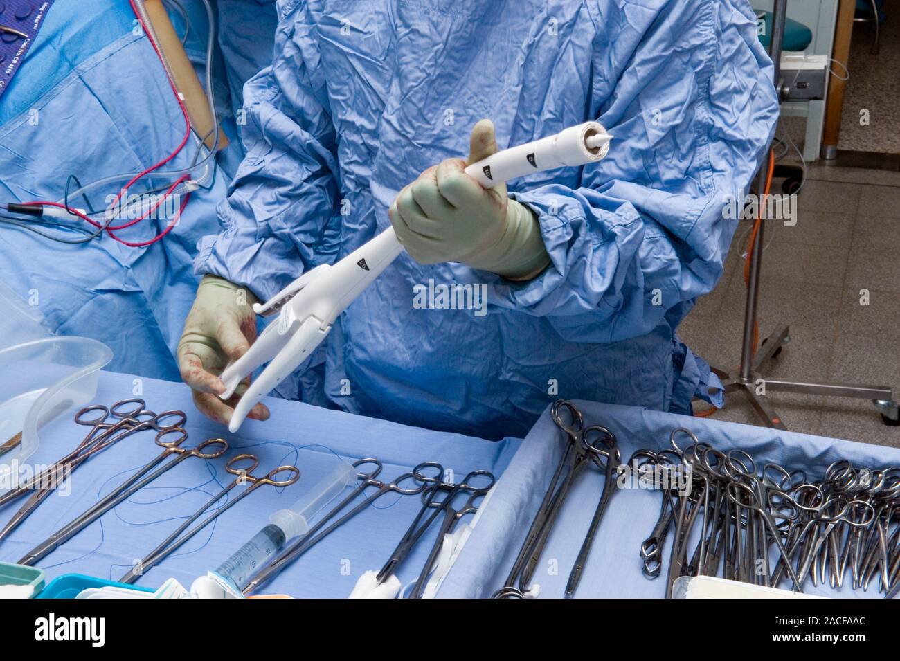 Oesophageal cancer surgery. Image 17 of 28. Surgeon preparing to use a ...