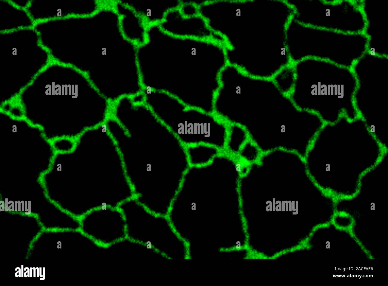 Endoplasmic reticulum, confocal light micrograph. A fluorescent dye has ...