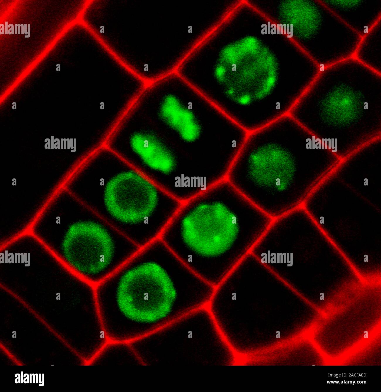 Mitosis in plant root. Confocal light micrograph showing epidermal ...