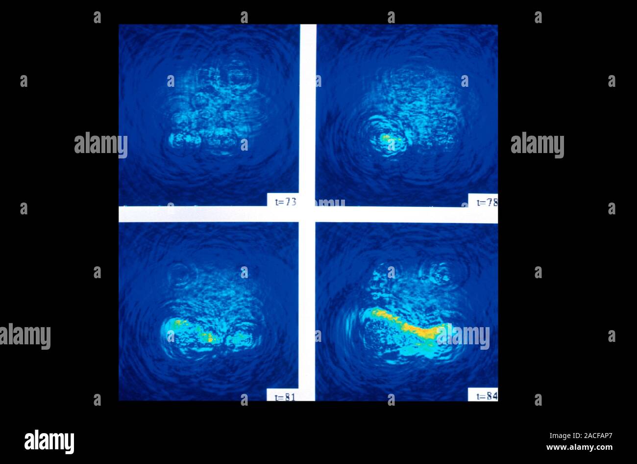 Seismic wave simulation. Digital simulation of the propagation of ...