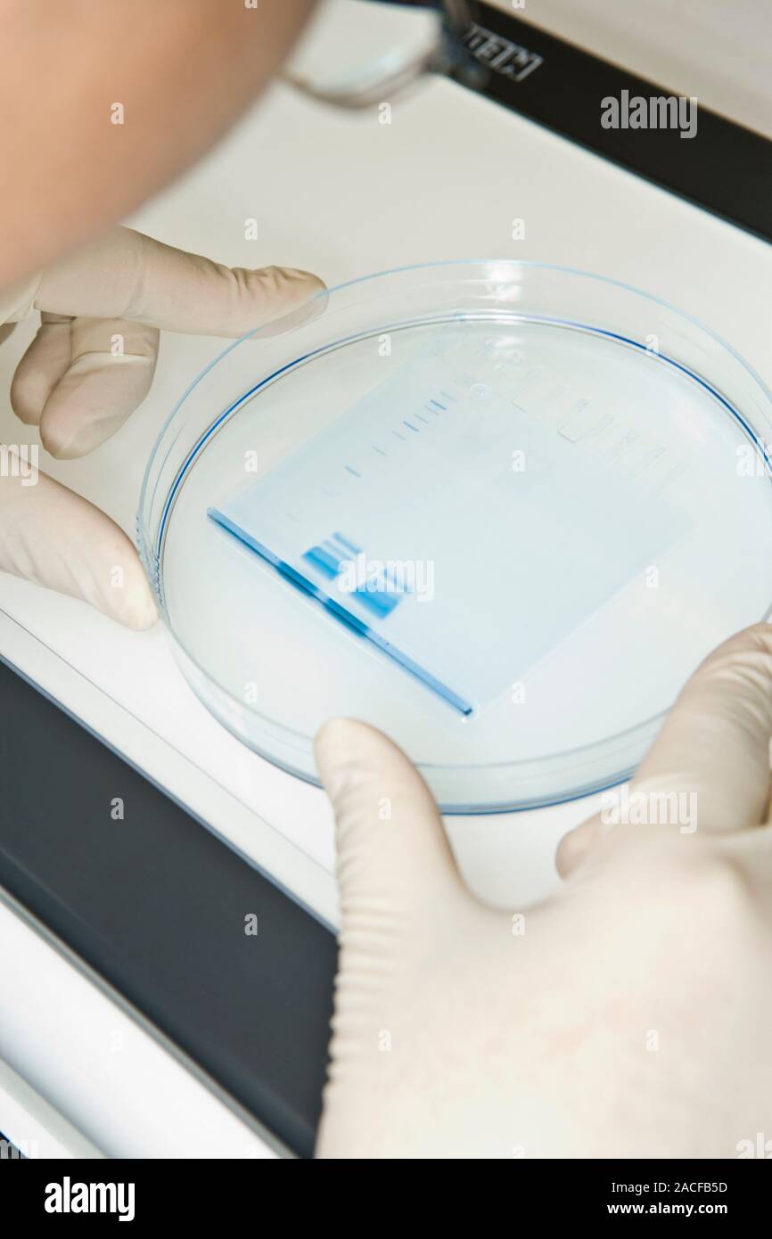 Protein analysis. Technician analysing a petri dish containing proteins ...