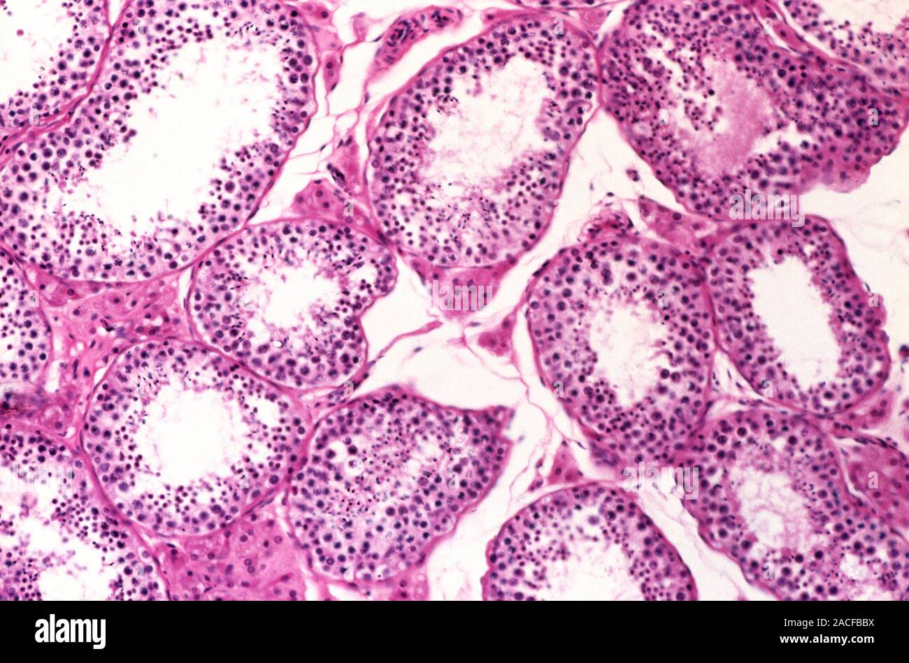 Seminiferous tubules. Light micrograph of tissue from a human testis ...