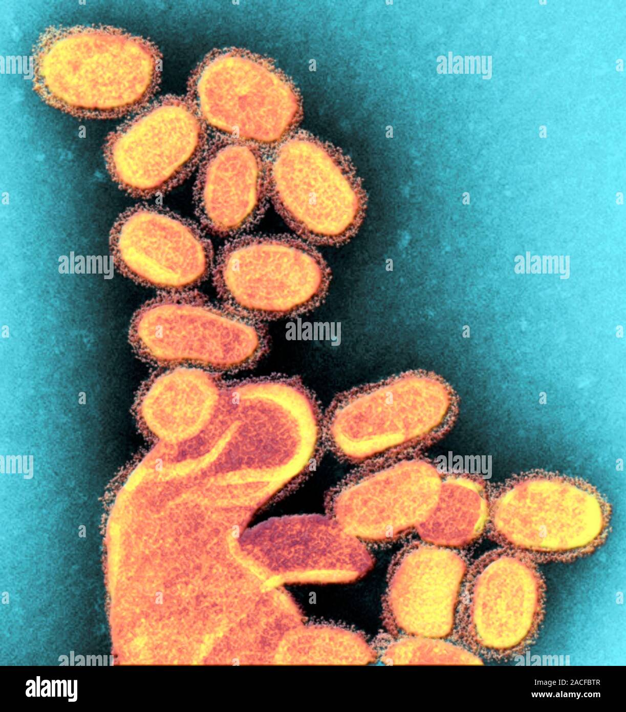 H1N1 1918 influenza virus particles, coloured transmission electron ...